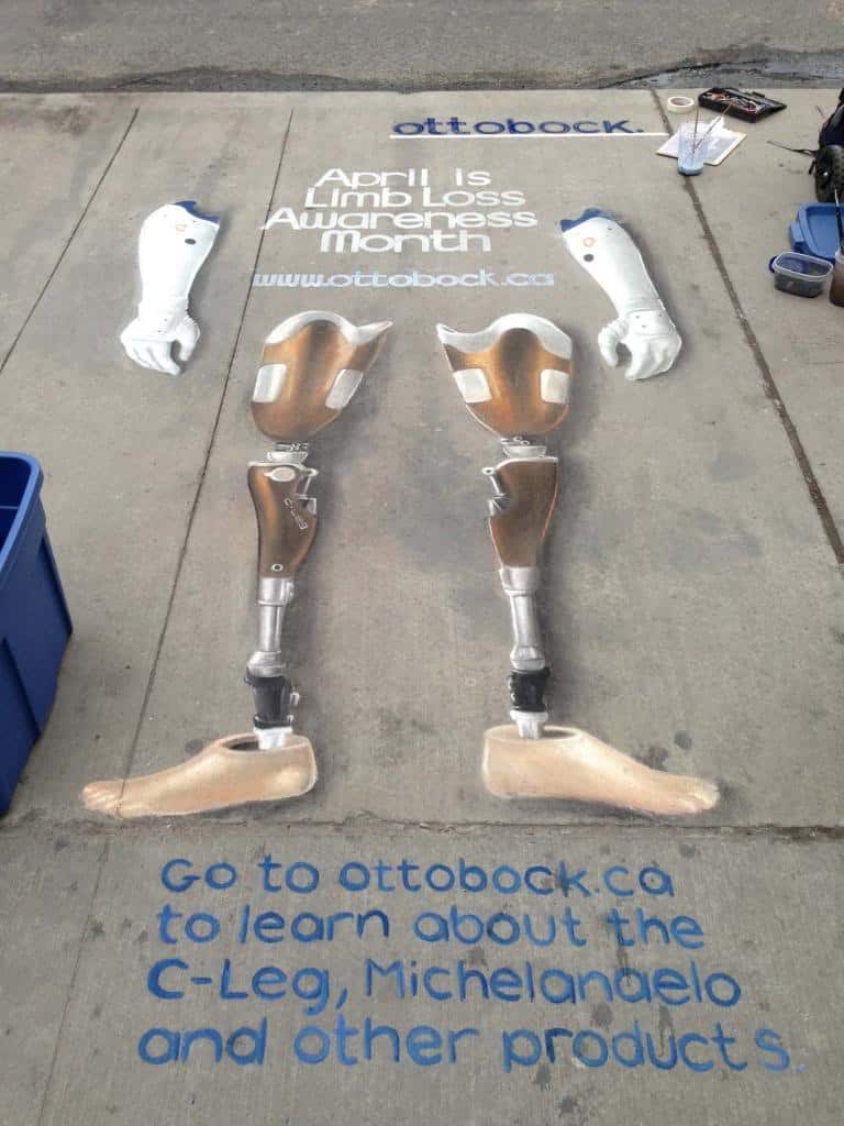 Limb Loss Awareness Month - Grassroots Advertising Inc.